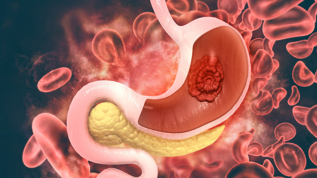 Gas in Stomach Explained - Causes, Symptoms & Remedies – Sova Health